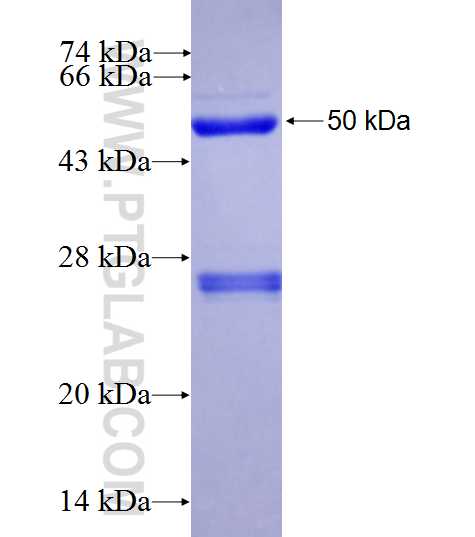 LEFTY1 Fusion Protein Ag27148 | Proteintech