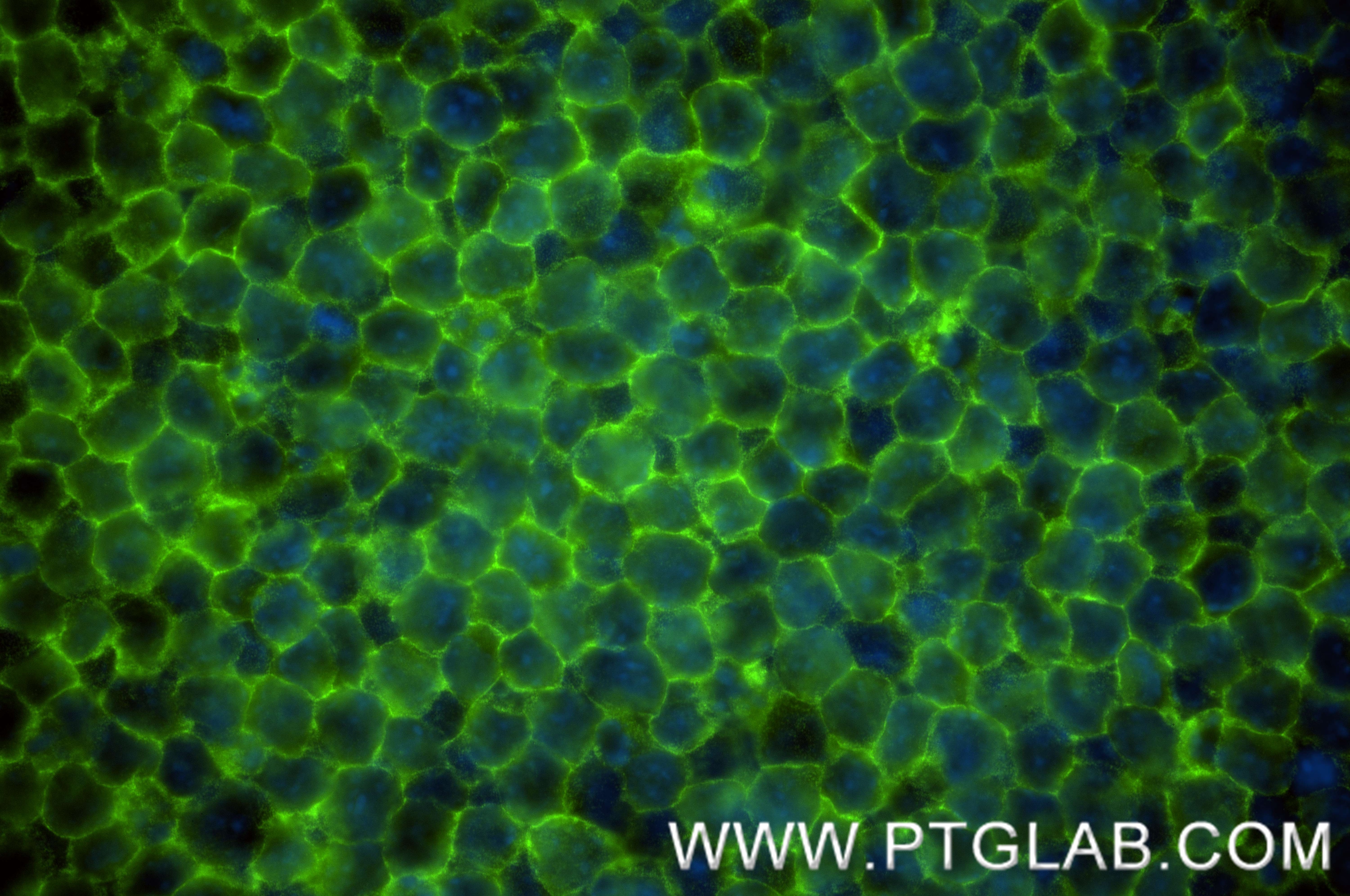 LY75/DEC-205 antibody (86590-3-PBS) | Proteintech