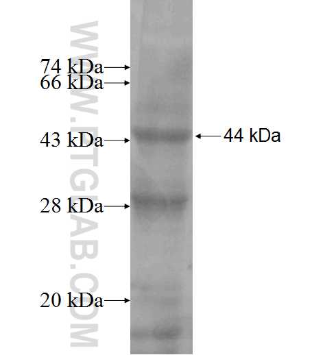 LY86 Fusion Protein Ag4494 | Proteintech