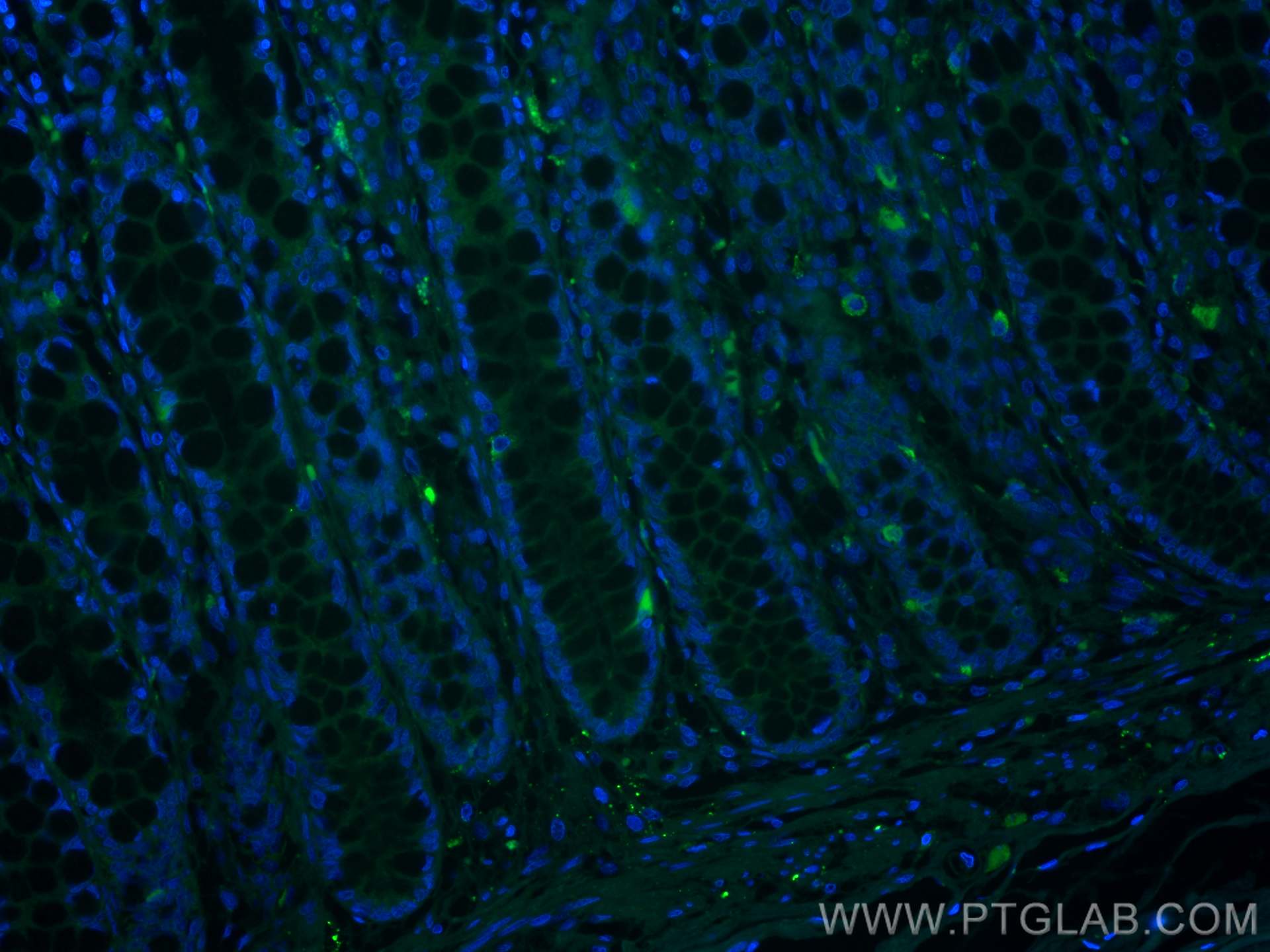 Lumican antibody (CL488-10677) | Proteintech
