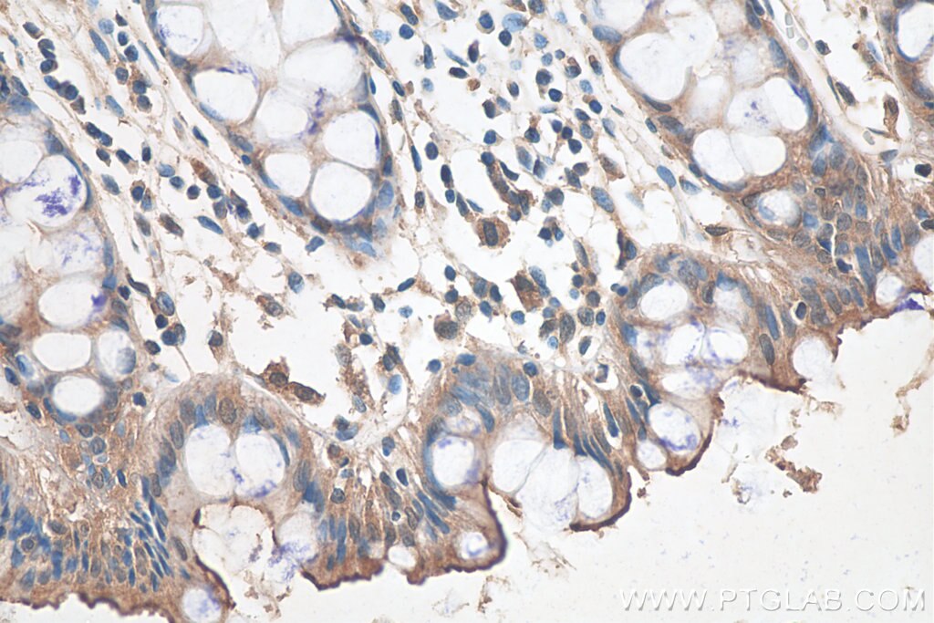 Lysozyme Fusion Protein Ag6917 | Proteintech