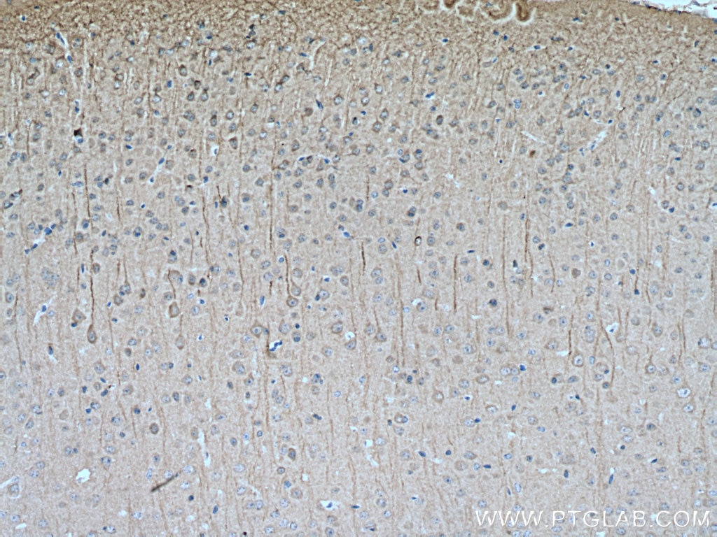 LC3 antibody (14600-1-AP) | Proteintech