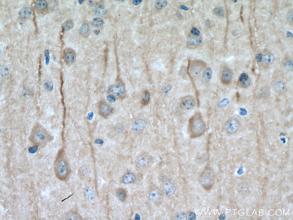 LC3 antibody (14600-1-AP) | Proteintech