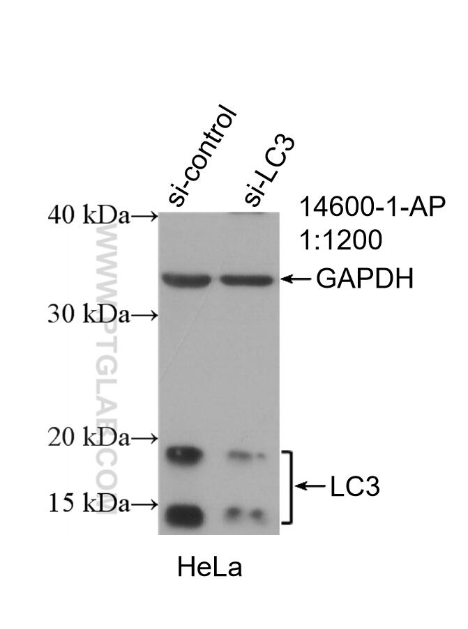 LC3 Rabbit Polyclonal antibody - United Bio Research