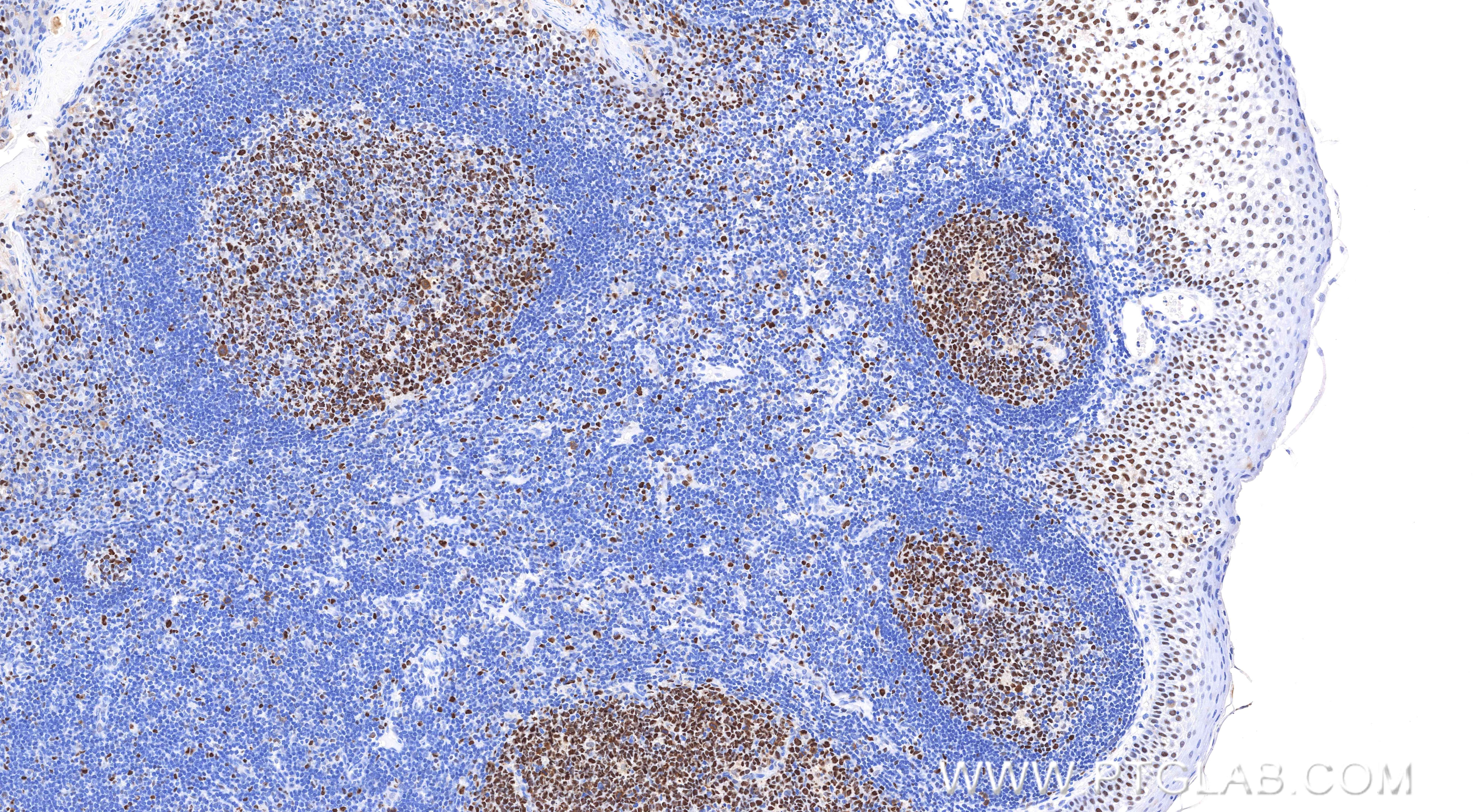 MCM2 antibody (84511-9-PBS) | Proteintech