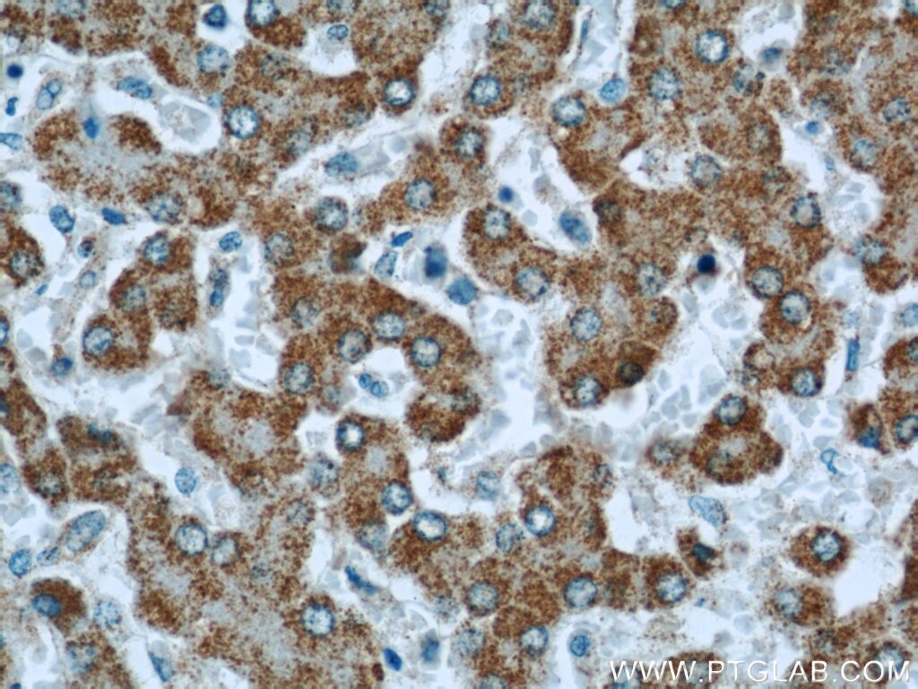 MLYCD antibody (15265-1-AP) | Proteintech