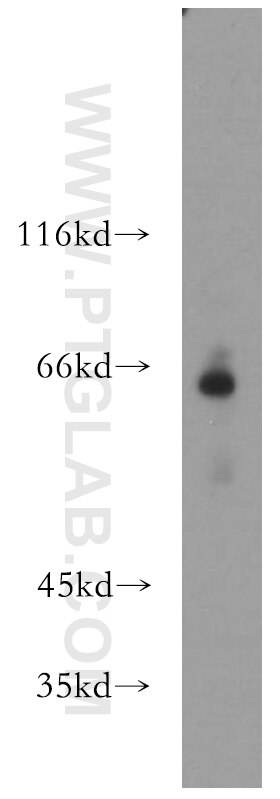 MLYCD antibody (15265-1-AP) | Proteintech