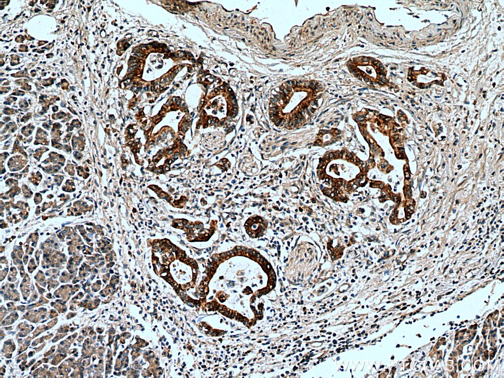 MMP1 antibody (10371-2-AP) | Proteintech