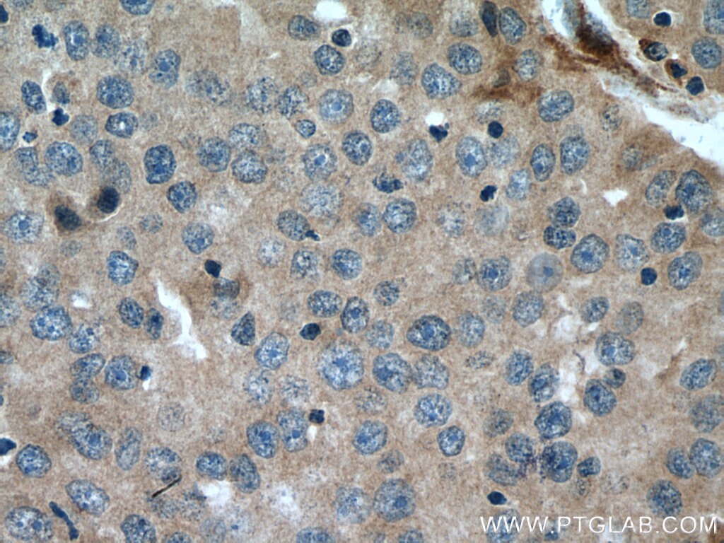 MMP1 antibody (10371-2-AP) | Proteintech