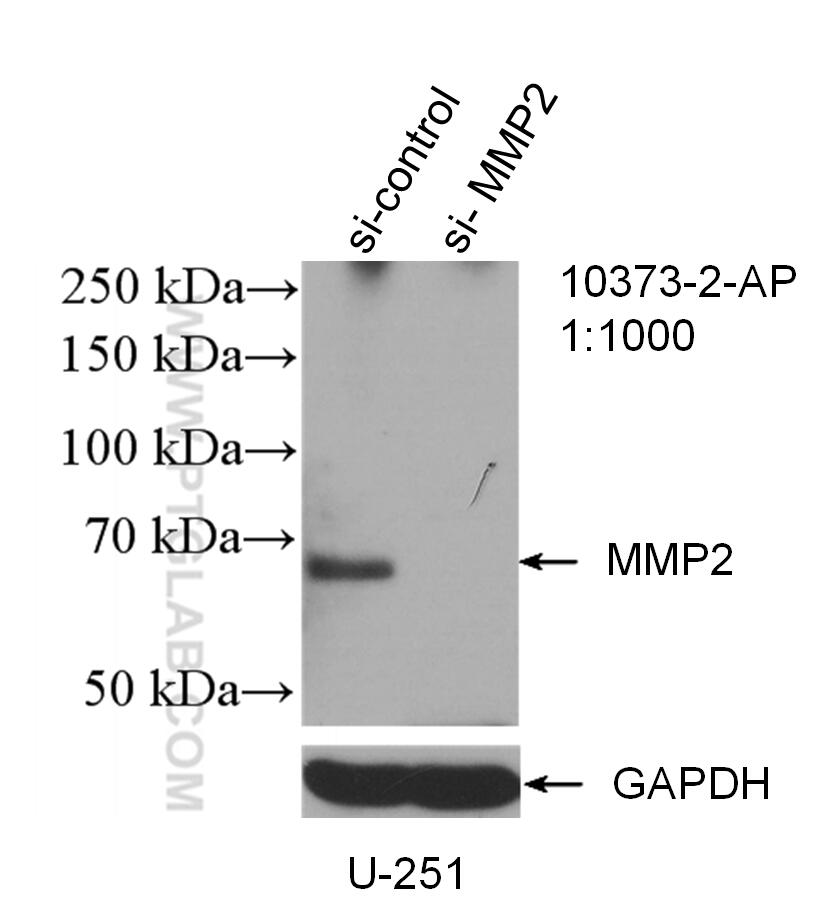 MMP2 antibody (10373-2-AP) | Proteintech