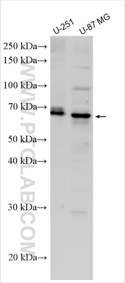 MMP2 antibody (10373-2-AP) | Proteintech