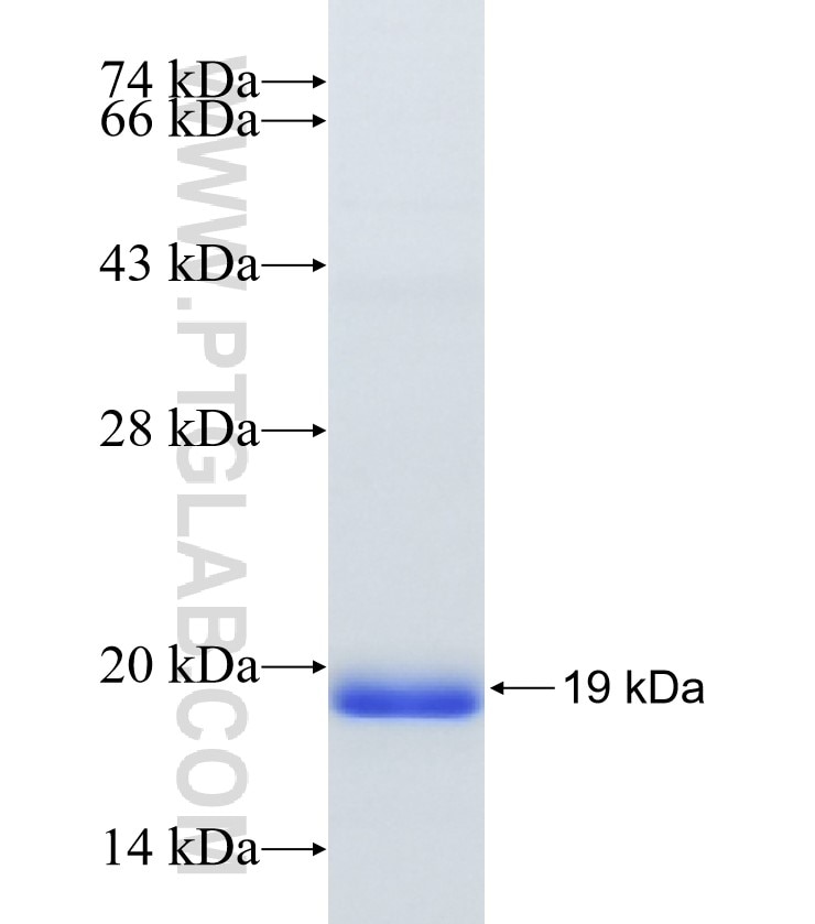 MMP25 Fusion Protein Ag33582 | Proteintech