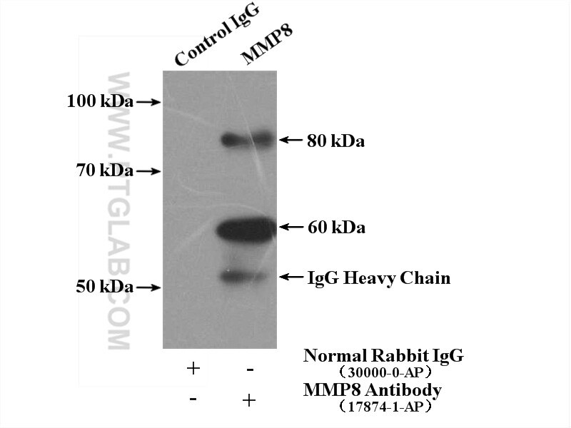 MMP8 antibody (17874-1-AP) | Proteintech