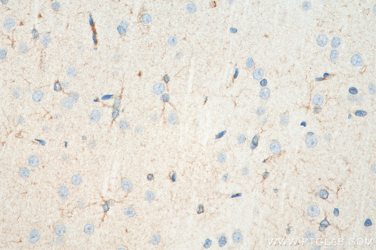 MOXD1 antibody (11545-1-AP) | Proteintech