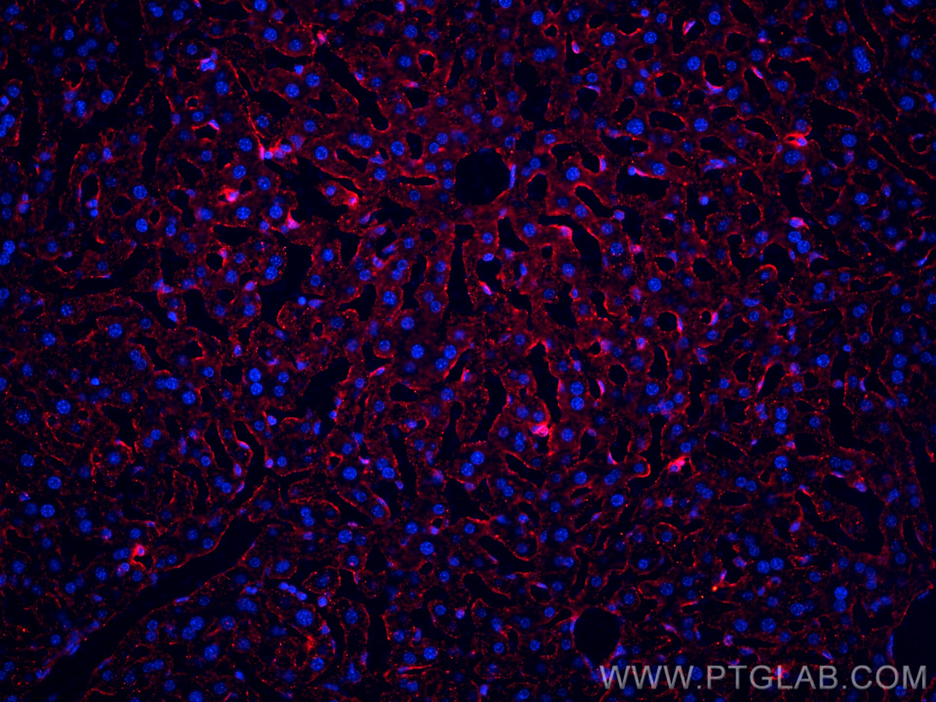 CD206 antibody (18704-1-AP) | Proteintech
