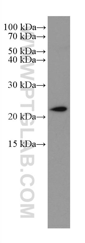 Mcp1 Fusion Protein Ag25031 | Proteintech