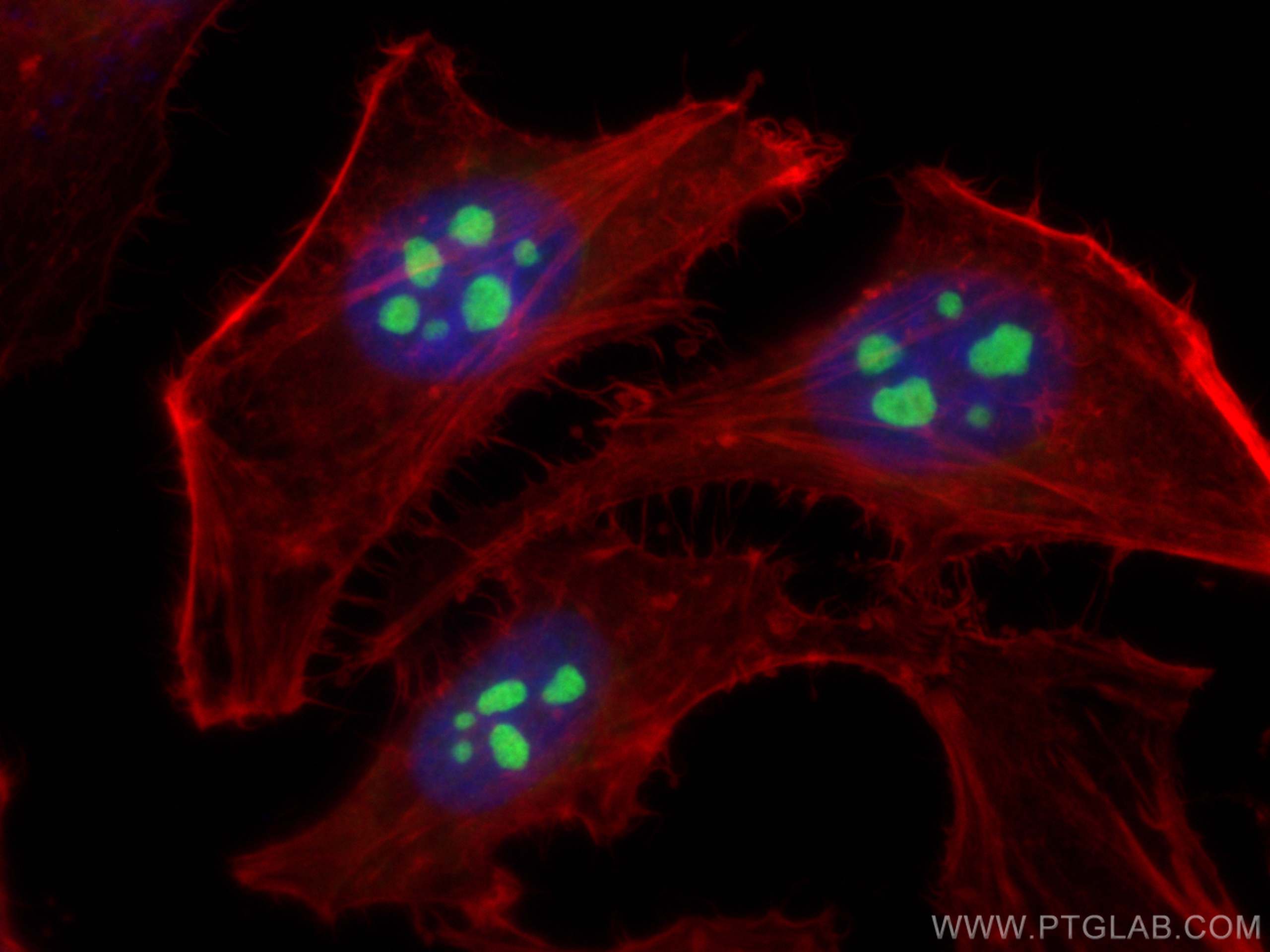 NAT10 antibody (13365-1-AP) | Proteintech