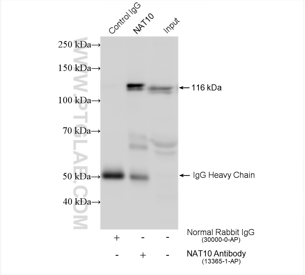 NAT10 antibody (13365-1-AP) | Proteintech