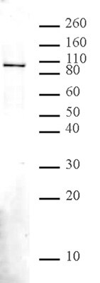 NBS1 antibody (pAb) | Proteintech