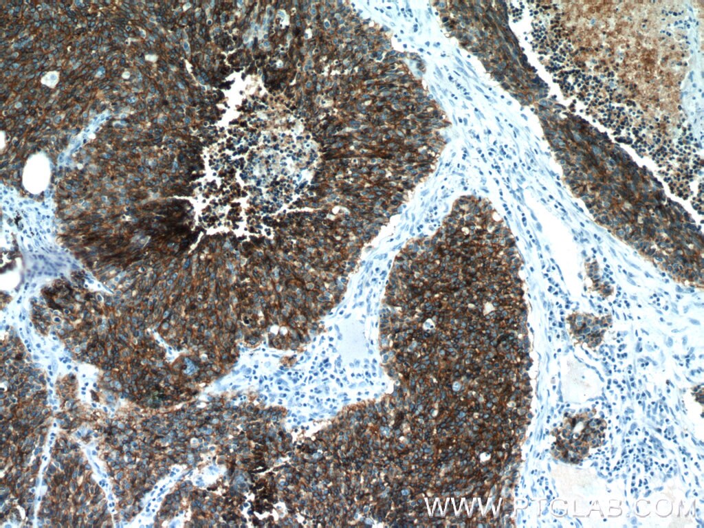 NCAM1/CD56 antibody (14255-1-AP) | Proteintech