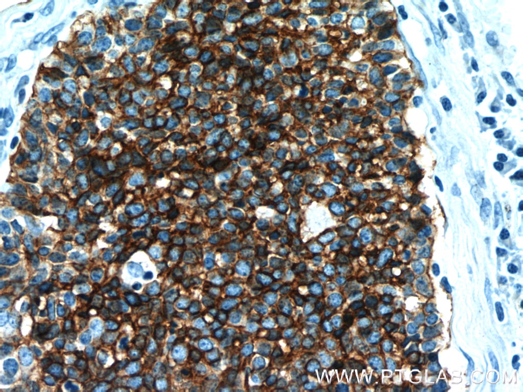 NCAM1/CD56 antibody (14255-1-AP) | Proteintech