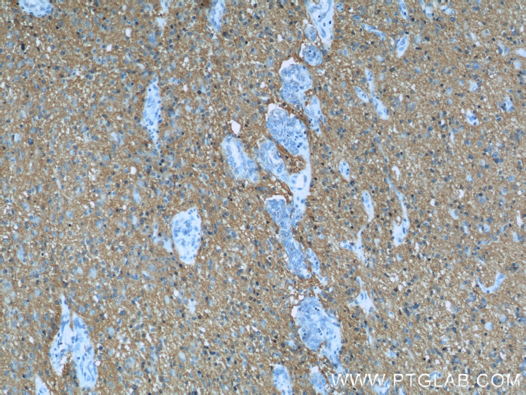 NCAM1/CD56 antibody (14255-1-AP) | Proteintech