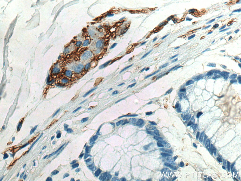 NCAM1/CD56 antibody (60238-1-Ig) | Proteintech
