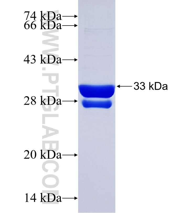 ND5 Fusion Protein Ag34495 | Proteintech