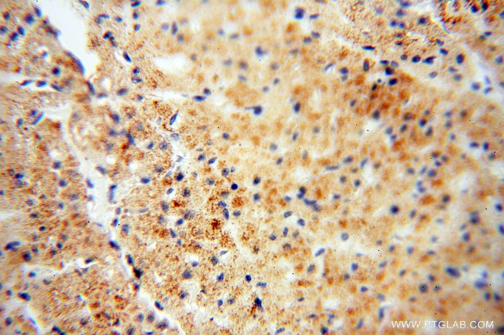 NDC80 Fusion Protein Ag8065 | Proteintech