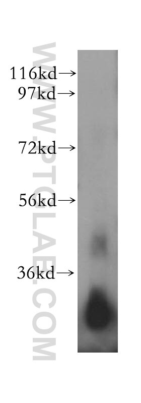 NDUFAF1 Fusion Protein Ag7224 | Proteintech