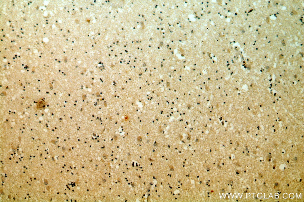 NF200 Fusion Protein Ag13520 | Proteintech