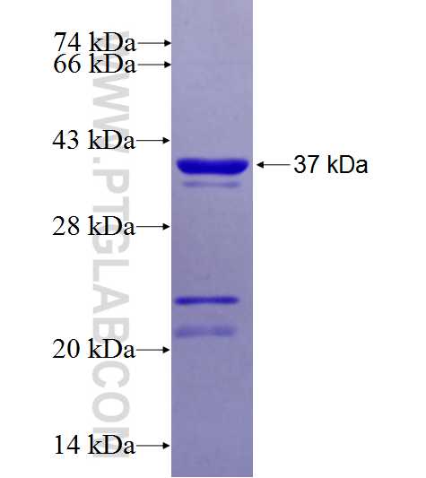 NEXN Fusion Protein Ag26921 | Proteintech