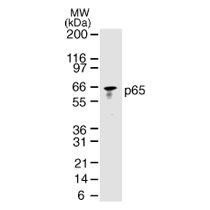 NFkB p65 antibody (mAb) (Clone 112A1021) | Proteintech