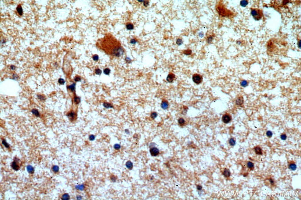 NISCH Fusion Protein Ag4880 | Proteintech