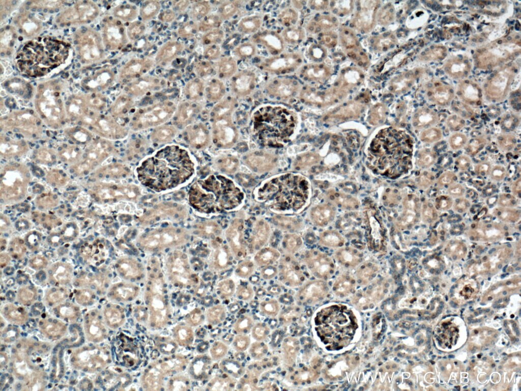NPHS2 Fusion Protein Ag14671 | Proteintech