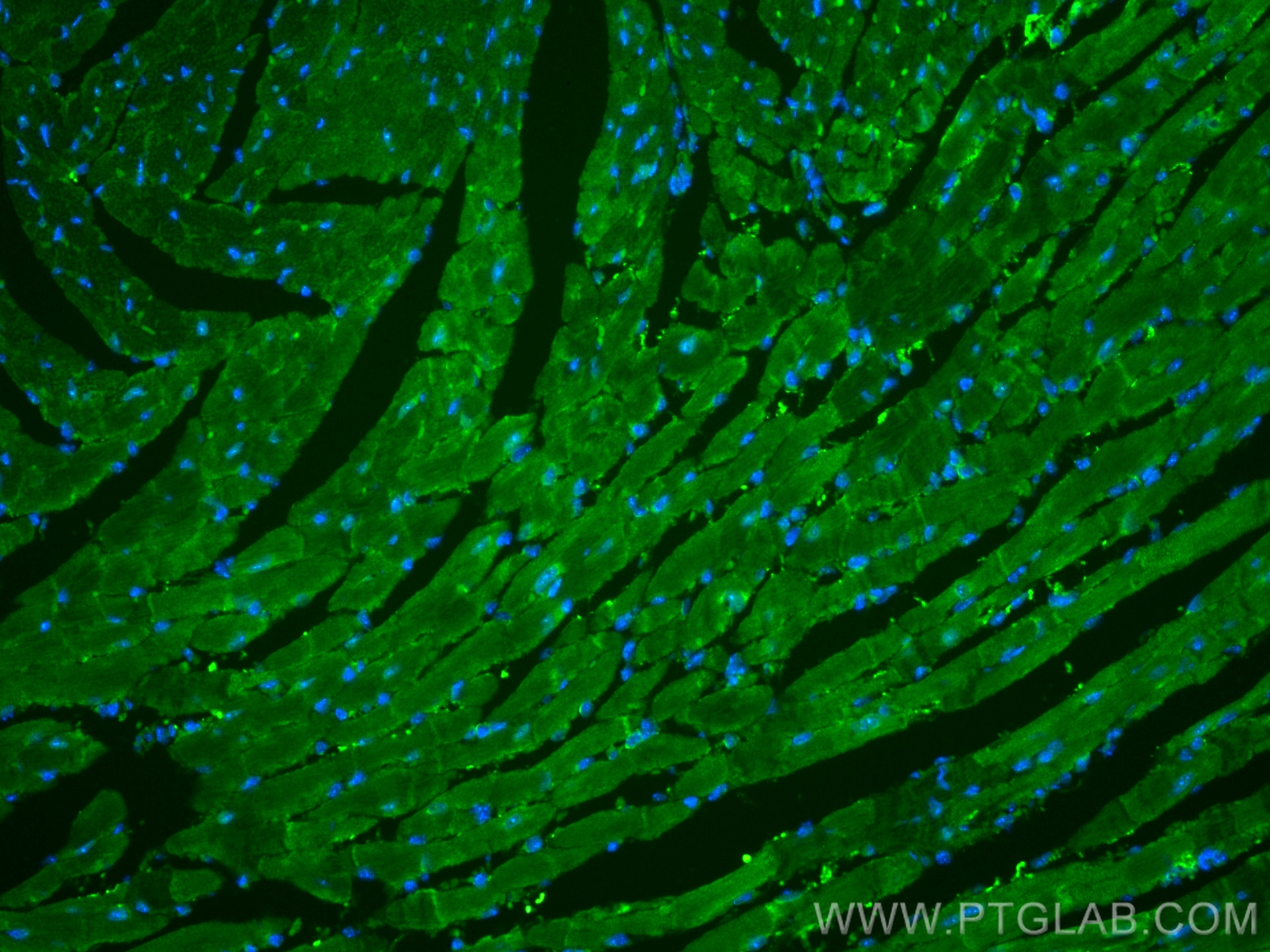 NPPC antibody (29352-1-AP) | Proteintech