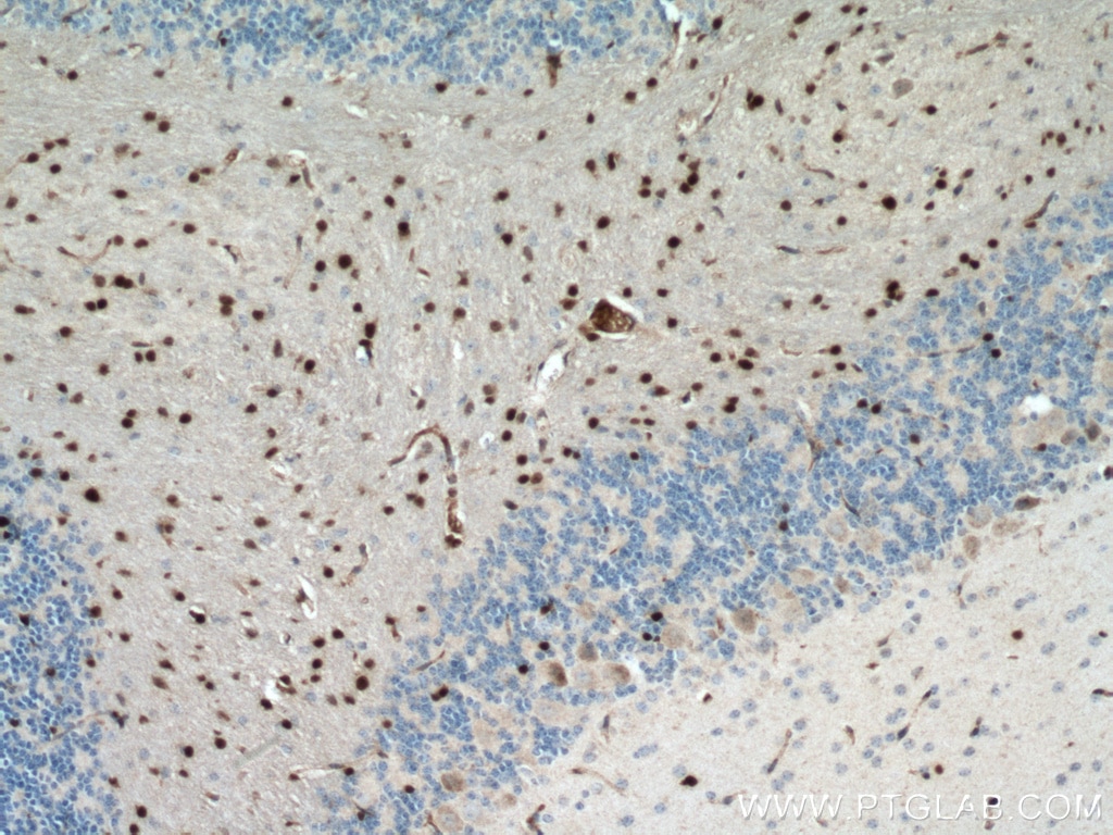 OLIG2 antibody (13999-1-AP) | Proteintech