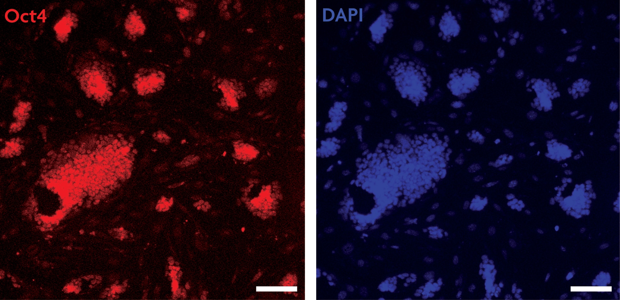 Oct-4 antibody (pAb) | Proteintech