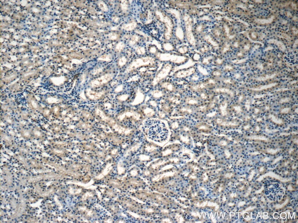 Osteocalcin antibody (23418-1-AP) | Proteintech