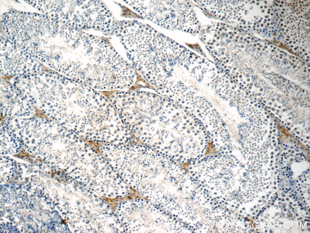 Osteocalcin antibody (23418-1-AP) | Proteintech