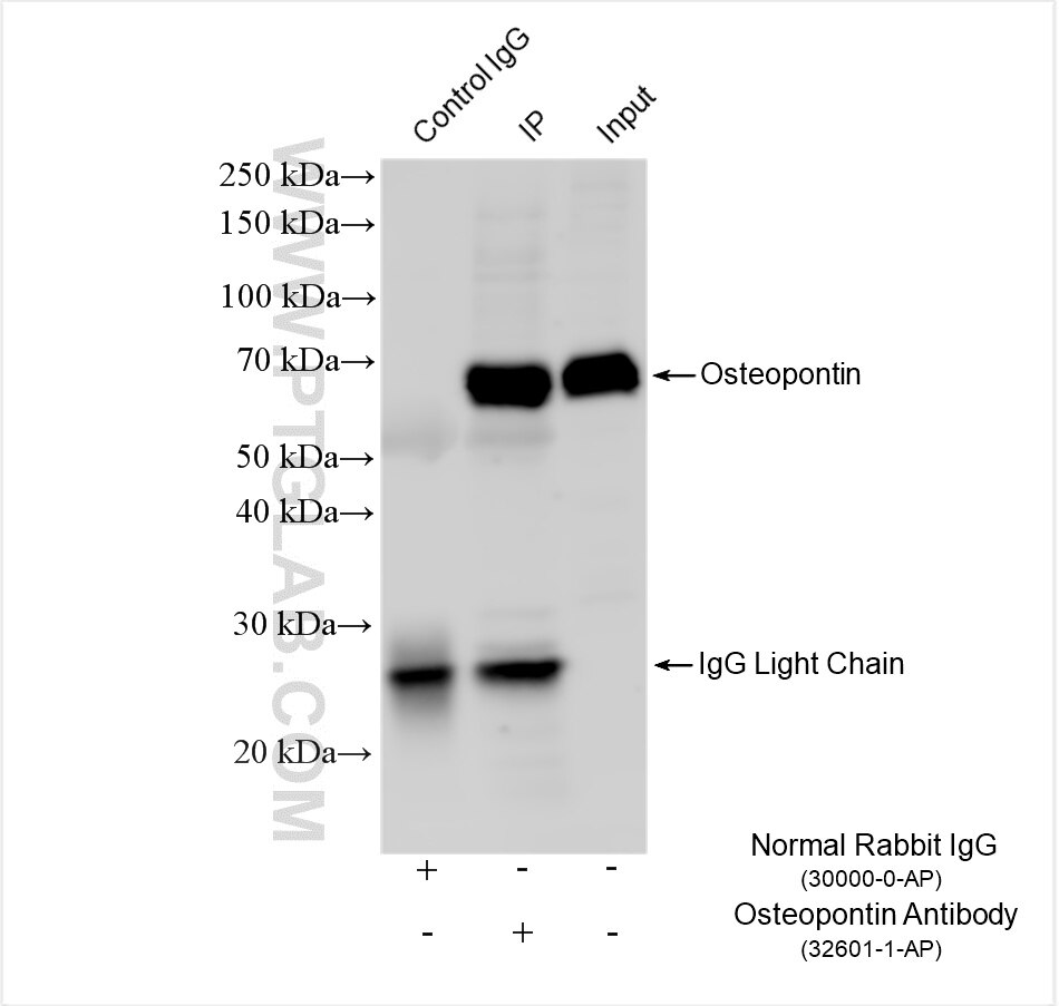 Osteopontin antibody (32601-1-AP) | Proteintech