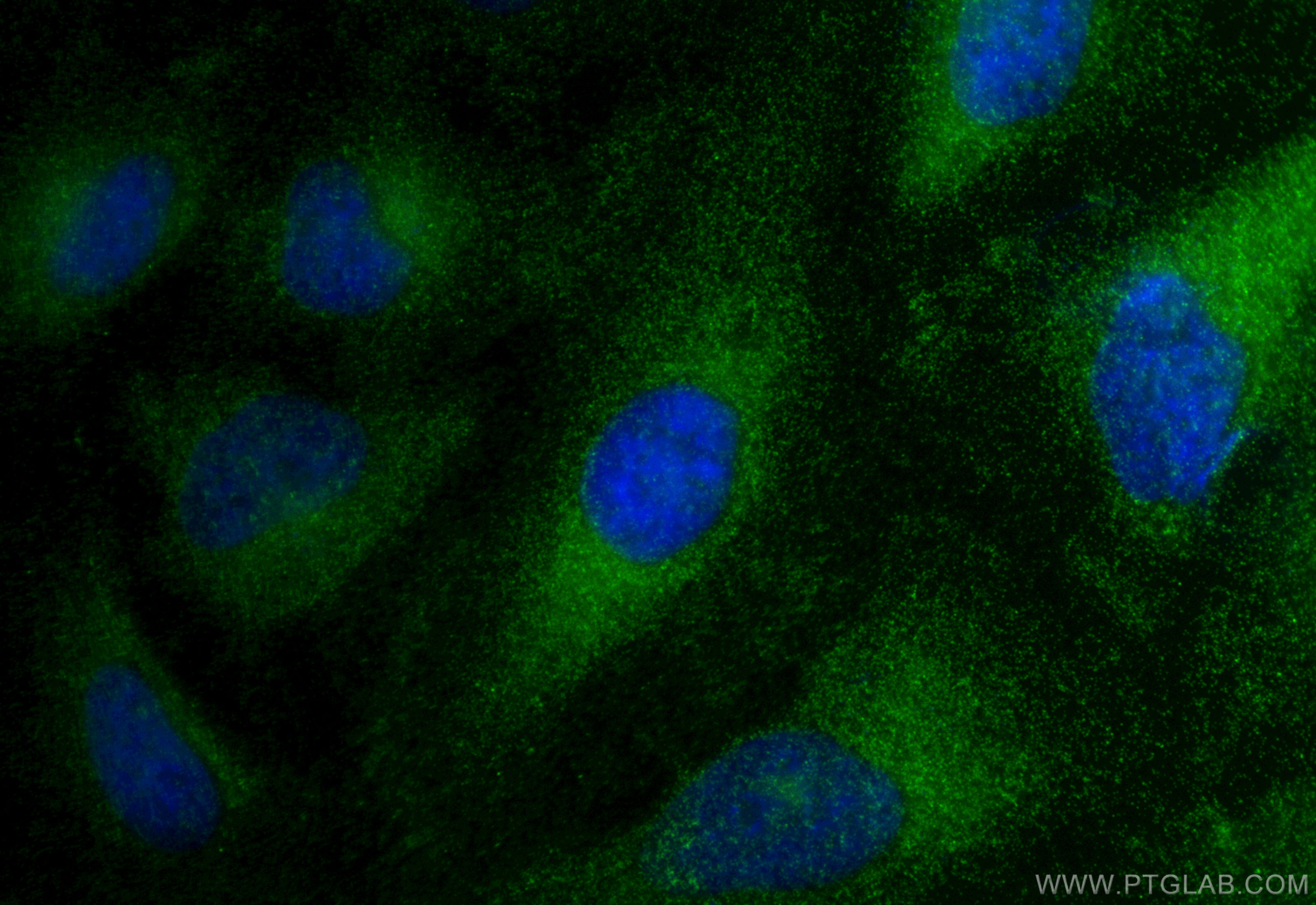 Osteoprotegerin/TNFRSF11B antibody (30870-1-AP) | Proteintech