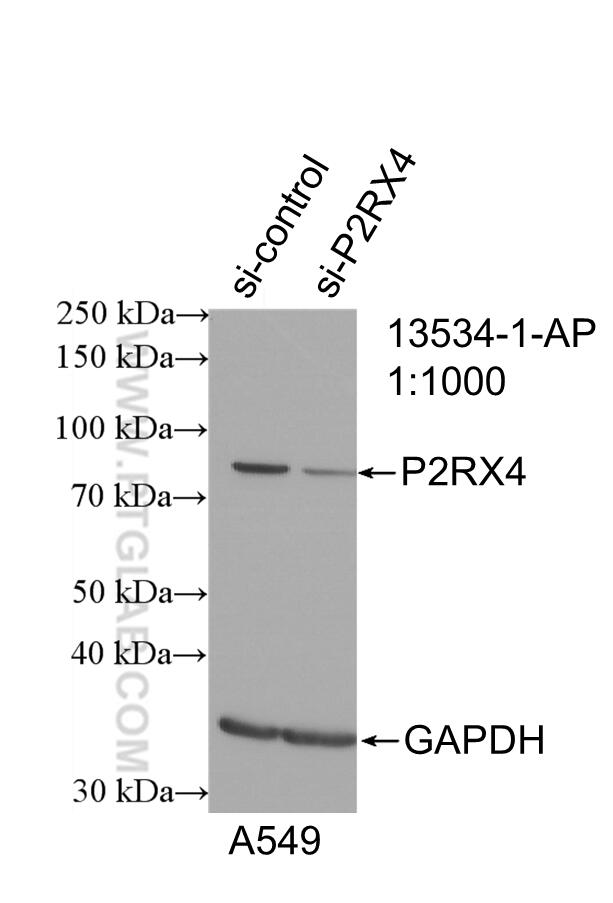 P2RX4 antibody (13534-1-AP) | Proteintech