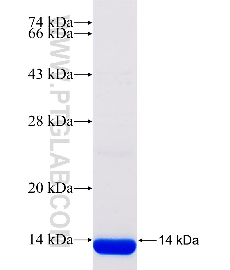 P2RY6 Fusion Protein Ag31387 | Proteintech
