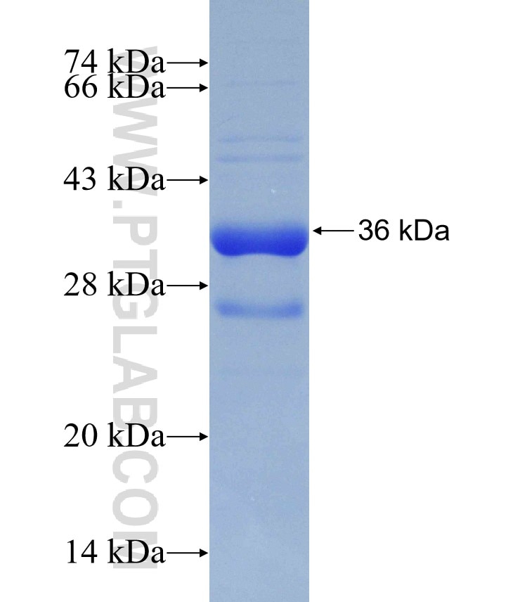 P54 of ASFV Fusion Protein Ag31481 | Proteintech