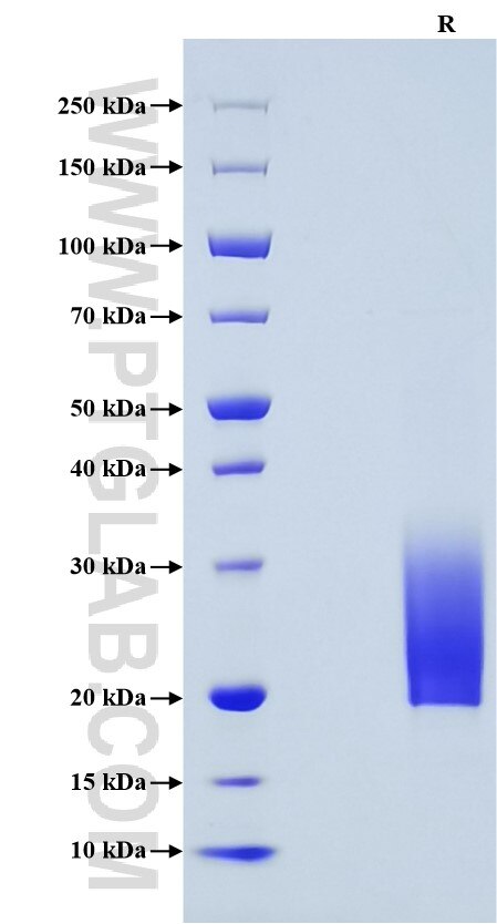 Recombinant Mouse IL-5 protein (His Tag) | Proteintech