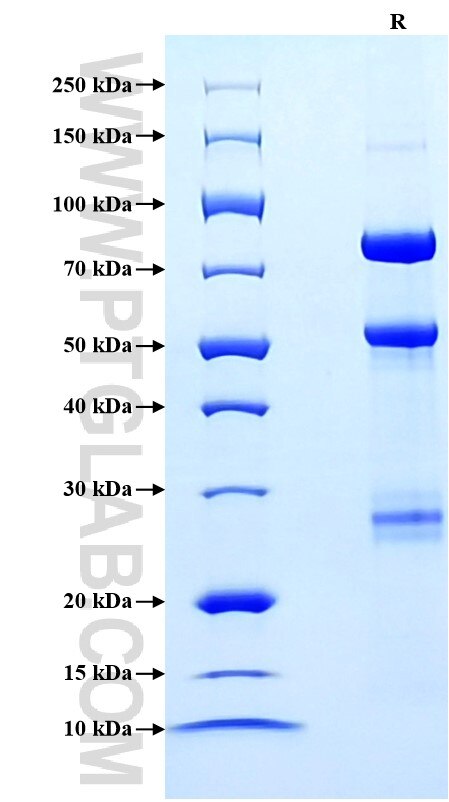 Recombinant Mouse Hgf protein (His Tag) | Proteintech