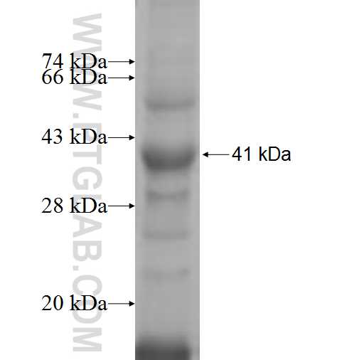 PALB2 Fusion Protein Ag5995 | Proteintech