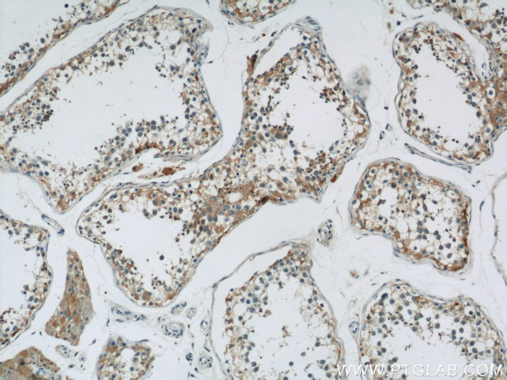 PAOX antibody (18972-1-AP) | Proteintech