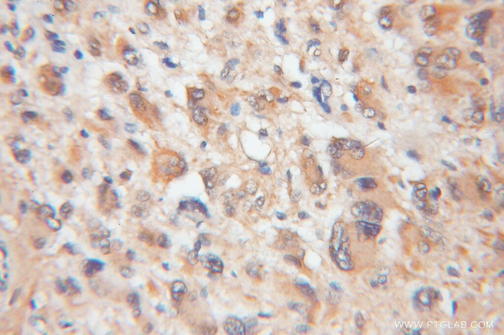 PARK7,DJ-1 Fusion Protein Ag2287 | Proteintech